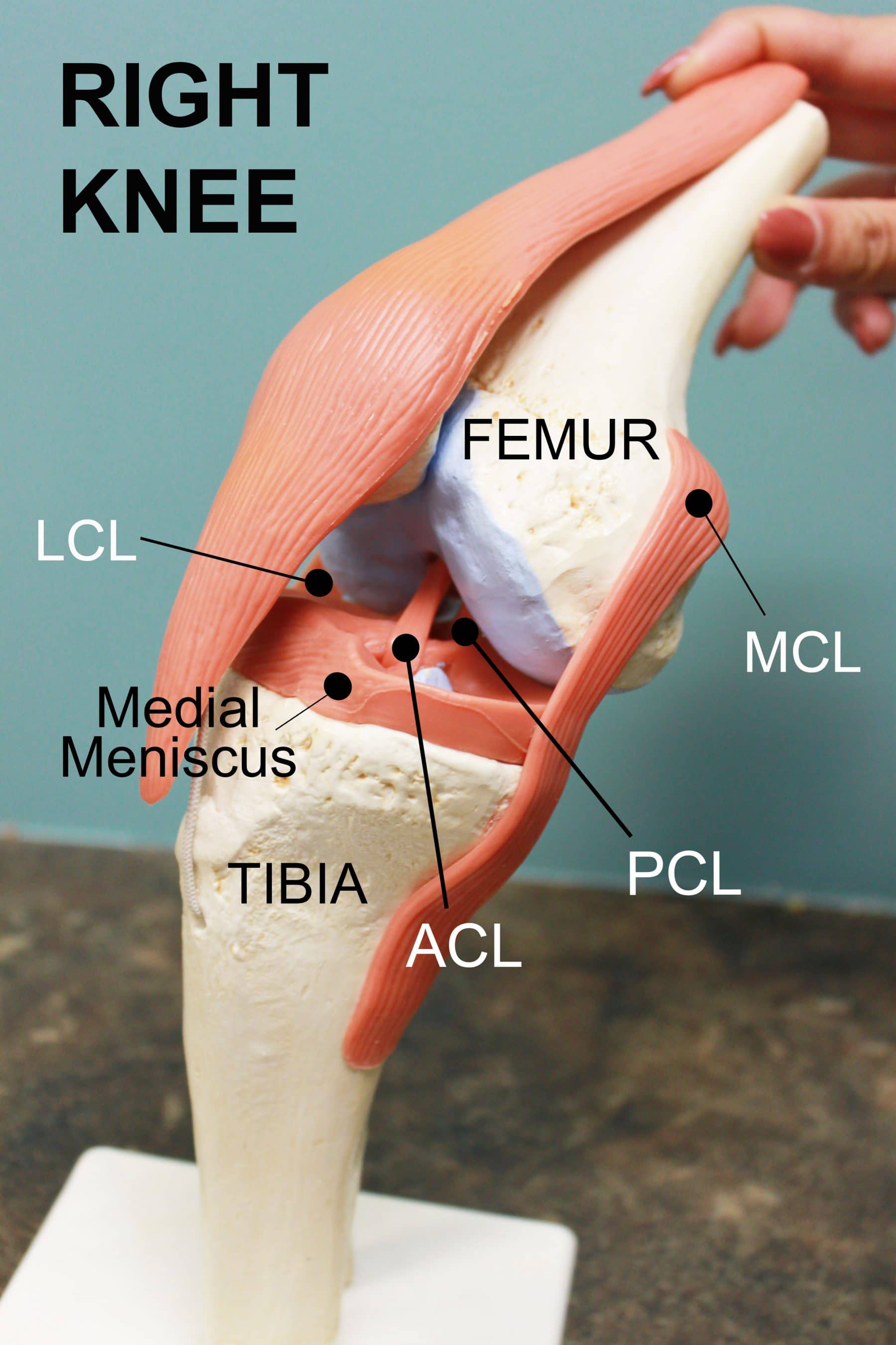 Acl Tear Diagram Minimalis