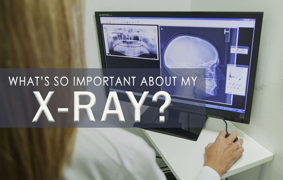 X–Ray-Feature-Image - Coury & Buehler Physical Therapy