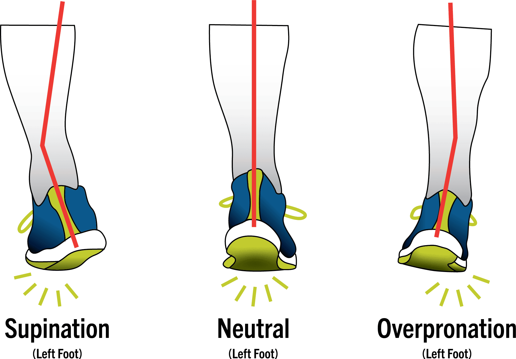 Foot Pronation Explained - Coury & Buehler Physical Therapy